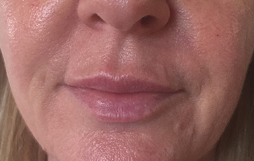 Gallery - Broseley Dental Practice