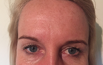 Gallery - Broseley Dental Practice